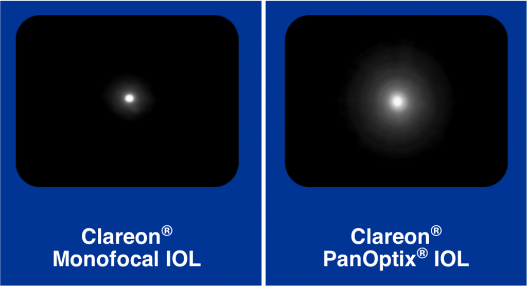 クラレオンパンオプティクス (Clareon PanOptix) | 新小岩眼科